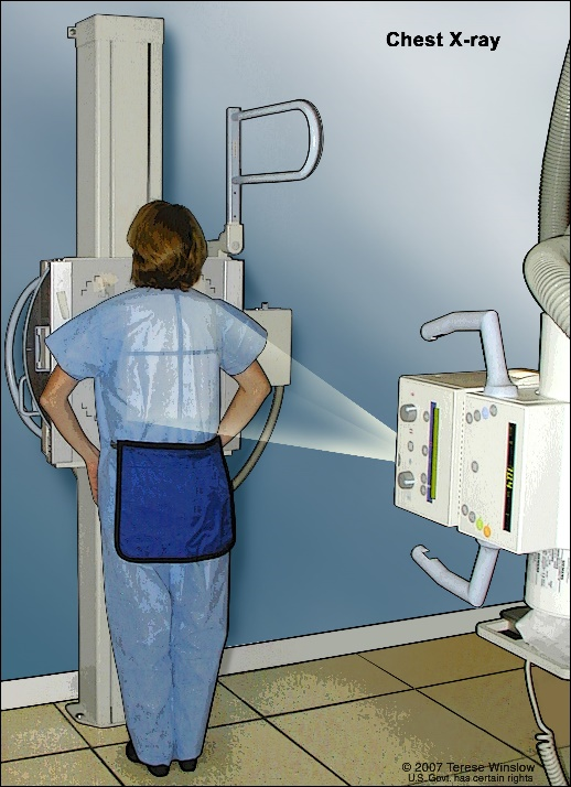 How to simulate X-ray medical imaging in Zemax OpticStudio – Ansys Optics